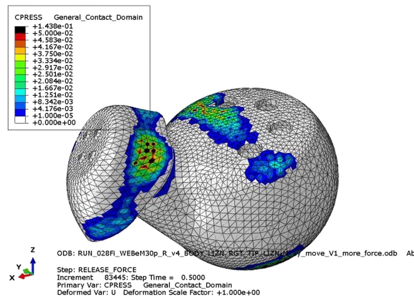 Will LIZN Hearpieces® fit my ears?